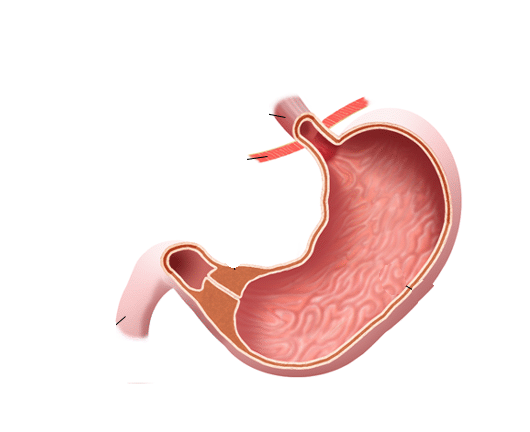 Özofagus Yanıkları - Prof. Dr. İbrahim Karnak
